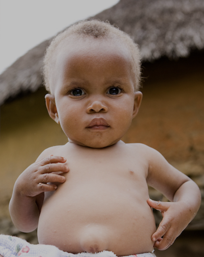 Maternal Health - RED